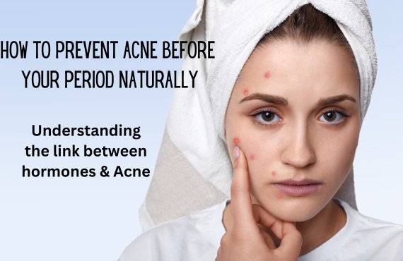 How to Prevent Acne Before Your Period Naturally – Makeup Stash Pakistan